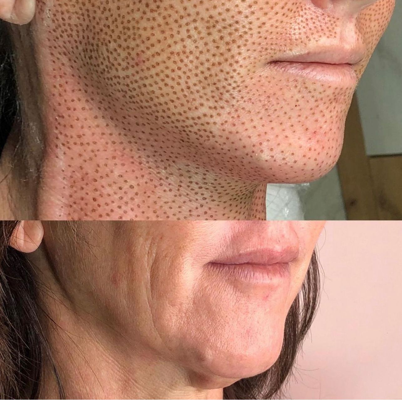 Plasma Lift | atelier-yuwa.ciao.jp